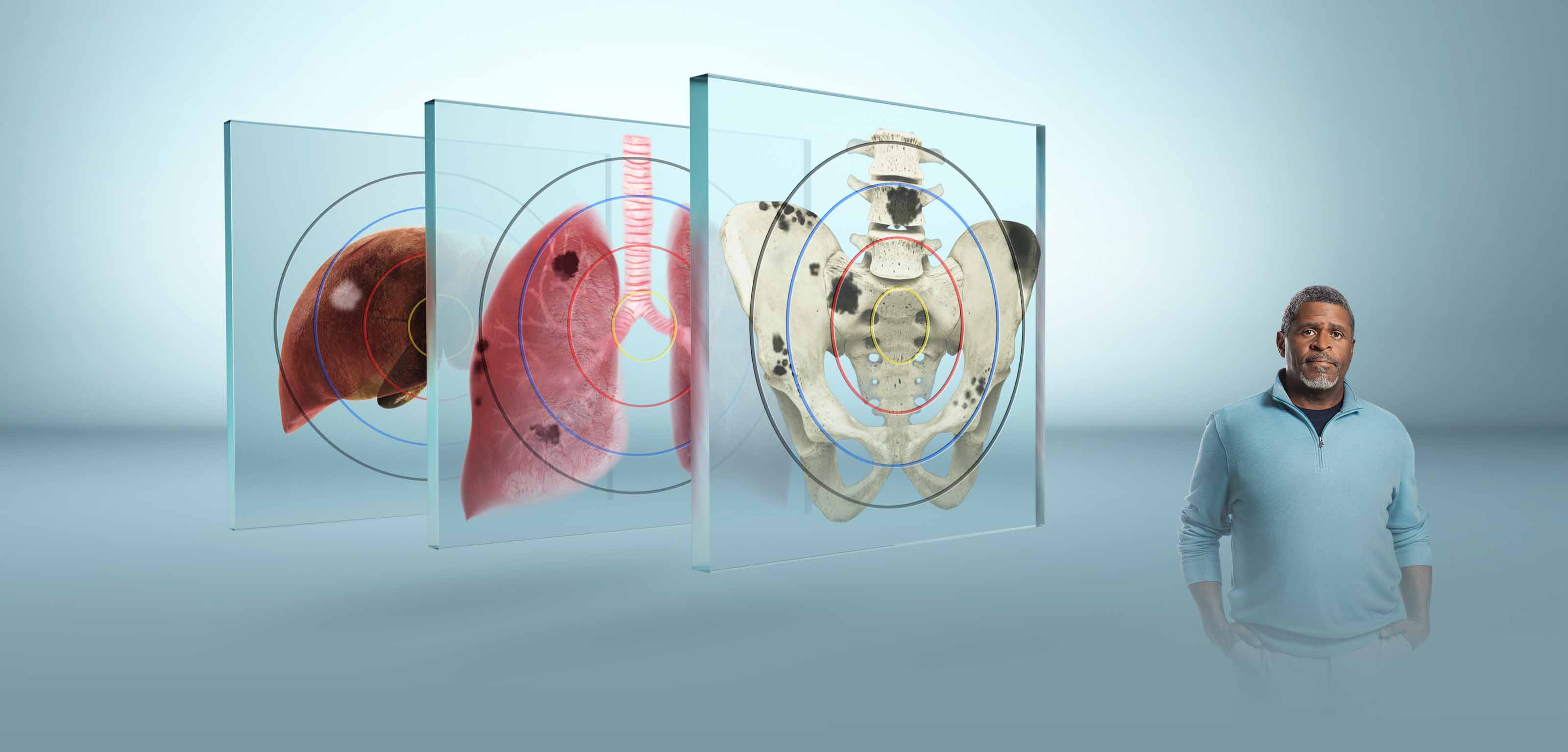 PSMA+mCRPC ad campaign for Pluvicto. Image of a man standing in front ...